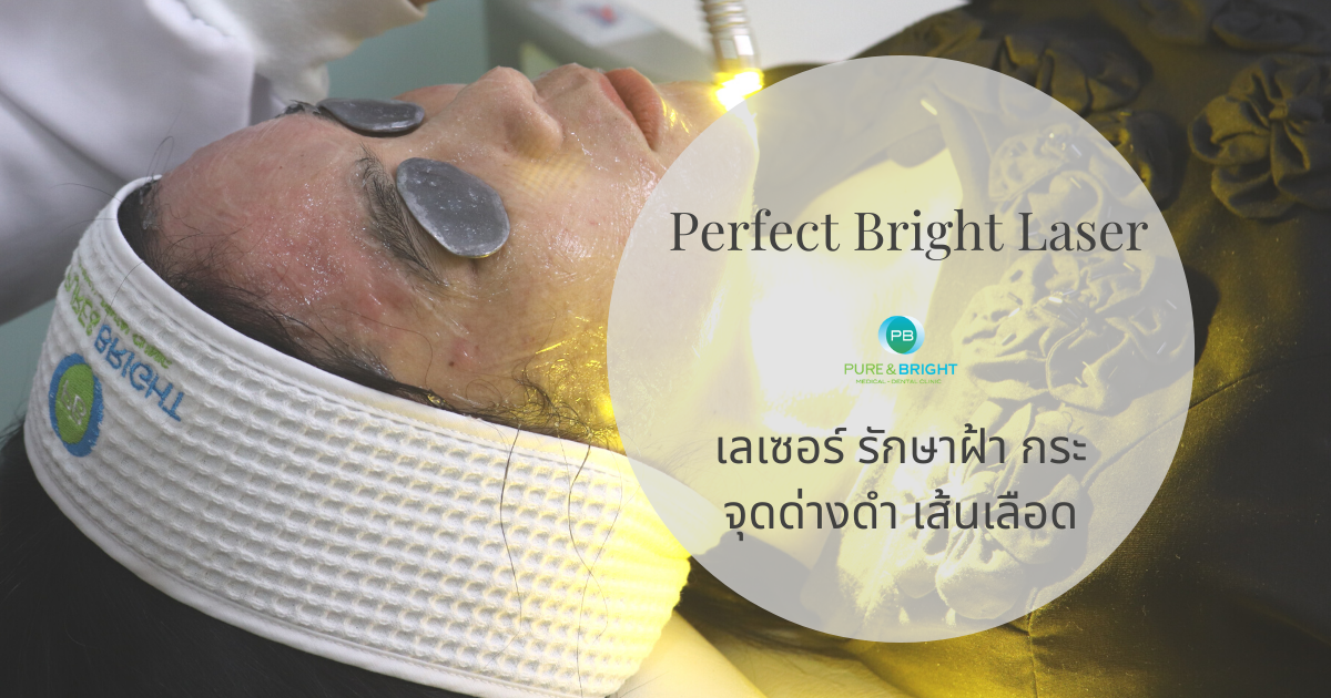 Perfect Bright Laser เลเซอร์หน้าใส ที่รักษา ฝ้า กระ จุดด่างดํา ฝ้าฮอร์โมน